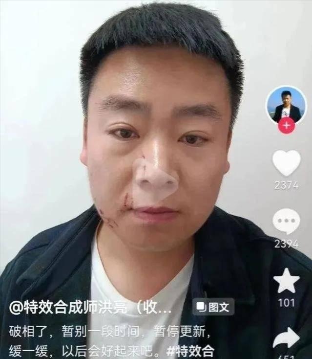 Male internet celebrity AI changed his face to look like himself and ...