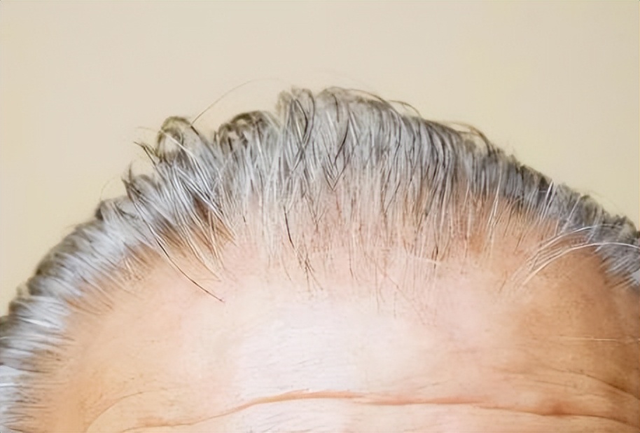 Where does the white hair grow, where does the disease come from?Long ...