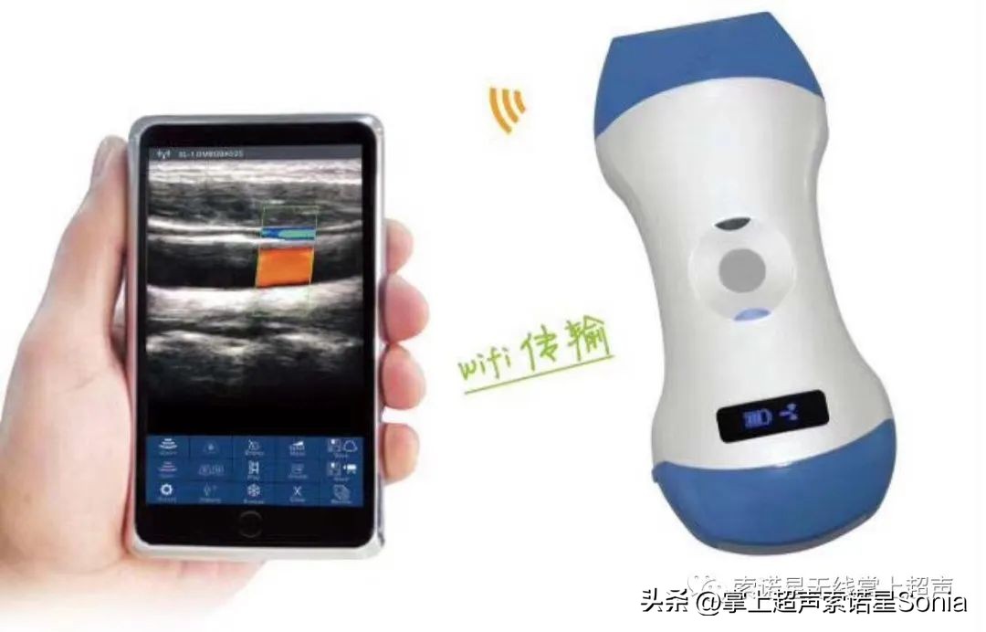 Sonostar Wireless Handheld Ultrasound Series - iNEWS