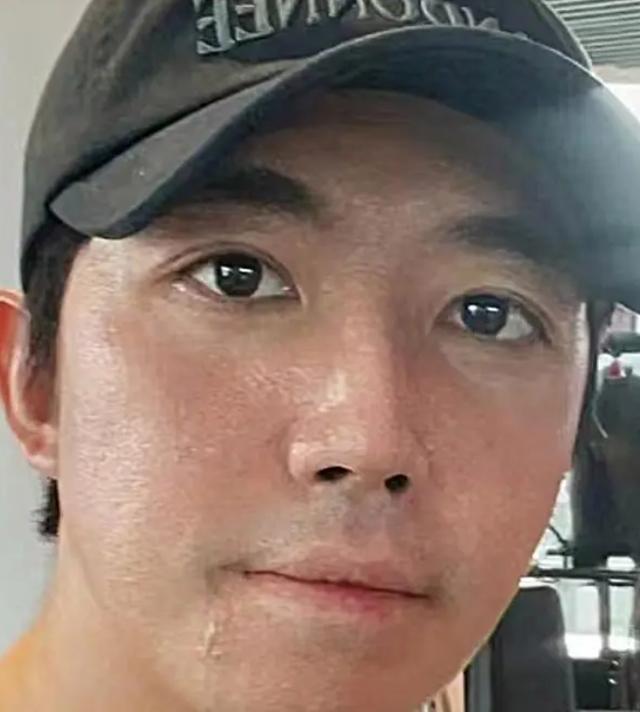 35-year-old Yu Haoming was accidentally encountered at the gym. His face is still full of scars ...