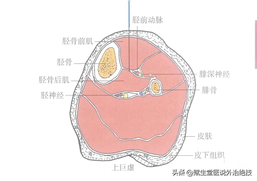 Key Points for Treating Intestinal Diseases - iNEWS