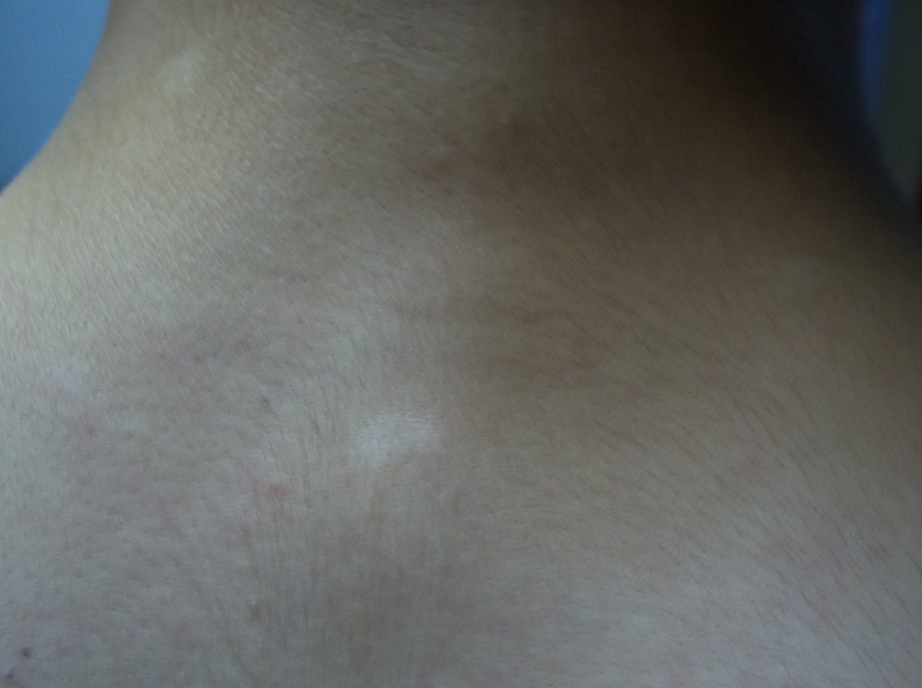 What's up with the white spots? - iNEWS