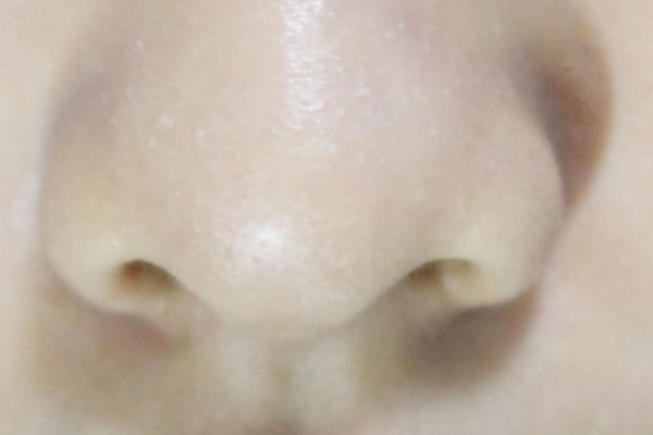 Why are your nose hairs sticking out?Nose hair "channeling" out, what ...