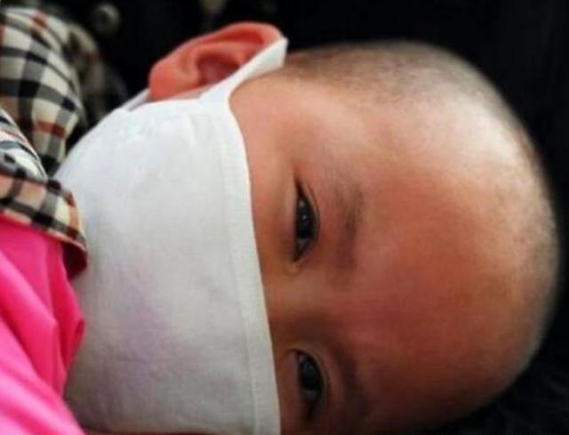 The child was admitted to the hospital due to formaldehyde poisoning ...