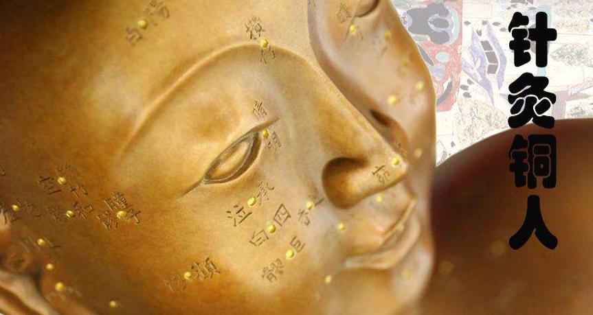 In the last century, Japan discovered an "acupuncture bronze man" in ...