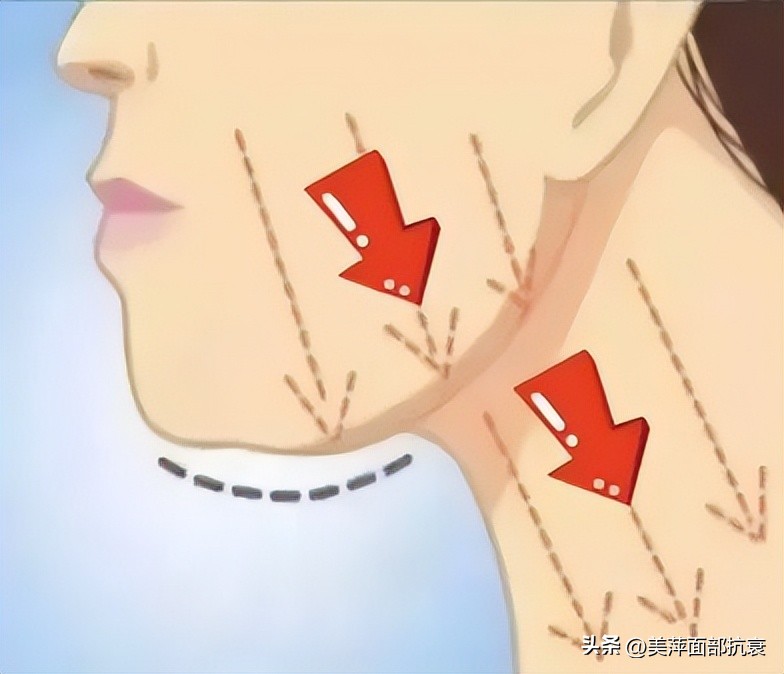 Even Tong Liya has not escaped the double chin problem, in fact, 2-step ...