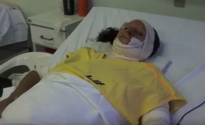 The world's first patient to receive the use of fish skin to treat ...