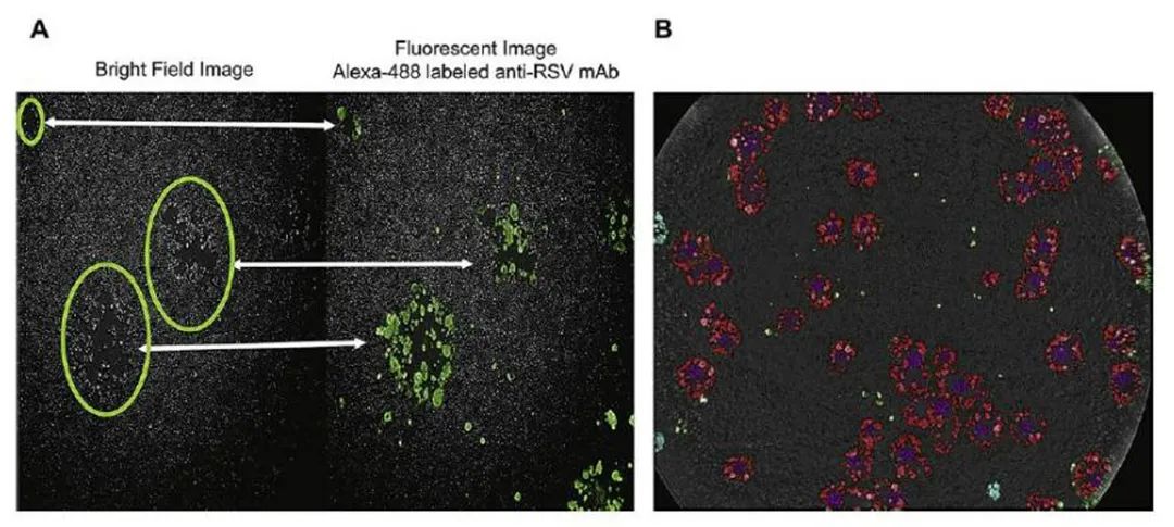 Plaque Assay: The Gold Standard for Quantifying Viruses - iNEWS