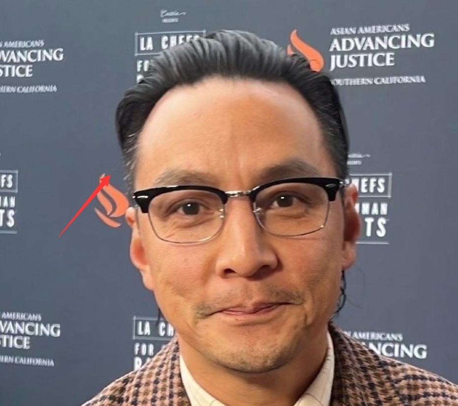 Wu Yanzu's recent photos turned into a greasy uncle, his hairline moved ...