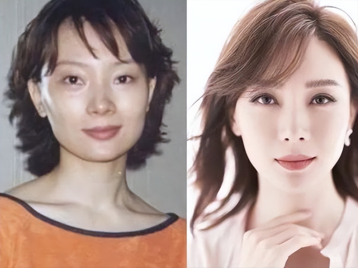 With sagging face, stiff expression, and swollen forehead, the middle-aged actor overturned the ...