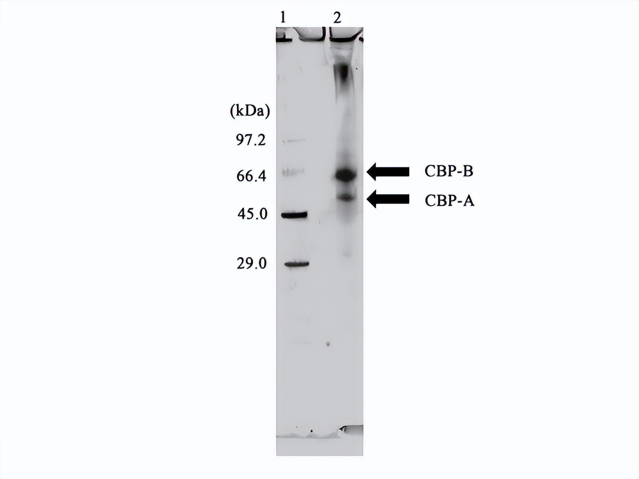 Cloning and analysis of cDNA of chitinase isoenzymes from the liver of ...