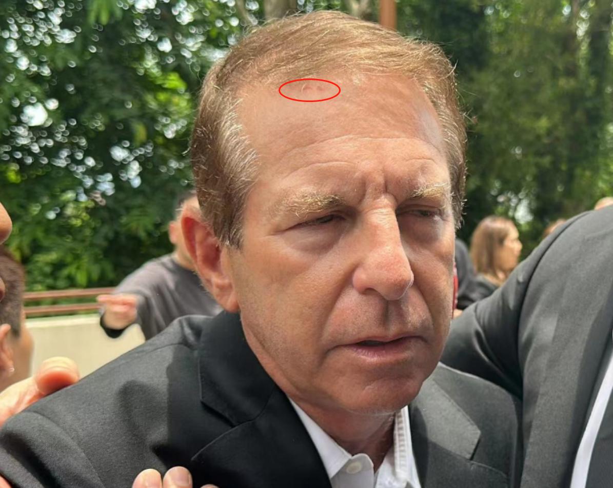 Coco Lee's husband was under siege! Two blood marks were pinched out of ...