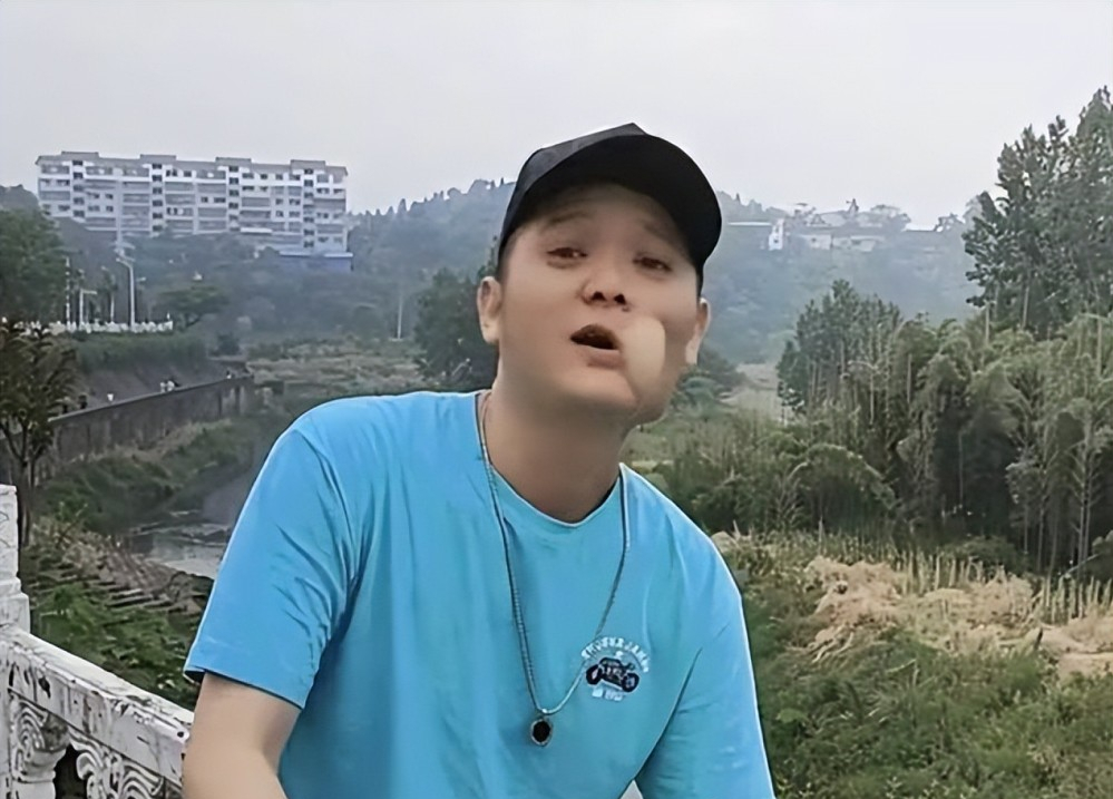 Fu Song: It's terrible!Singer died of cancer after chewing betel nut ...