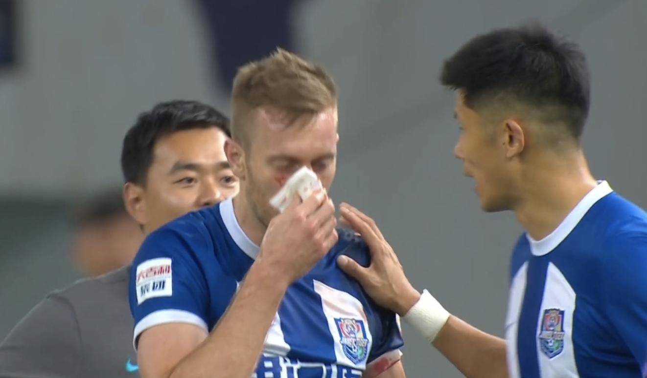 Juddson punches Berridge for fear of being punished, fans: well played ...