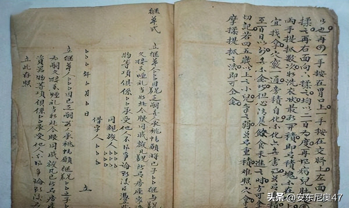 Emperor Tongzhi, who died at the age of 19, died of smallpox or ...