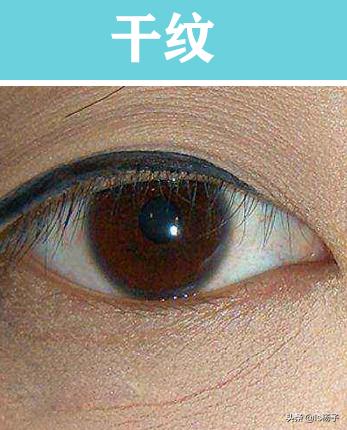 What is the difference between fine lines and wrinkles?How to remove ...