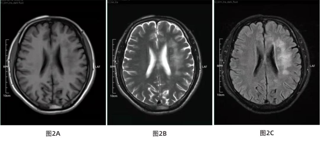 Scalp "knife cut" sign?There is another "hidden feeling" in the skull ...