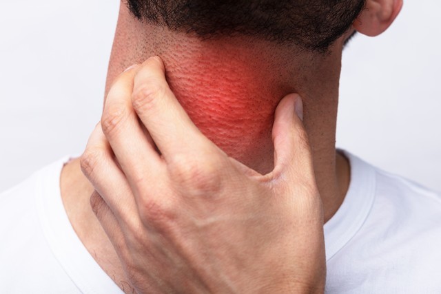 Acid reflux heartburn, foreign body sensation in the throat, difficulty ...