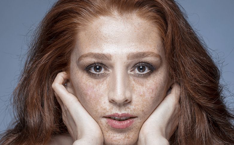 Too many spots on your face? Hidden in the daily method, help you solve ...