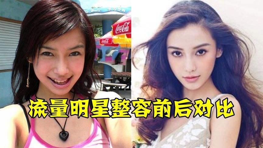 These female celebrities have obvious signs of plastic surgery, but ...