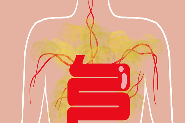 I often fart and the smell is pungent. Is there an abnormality in the ...