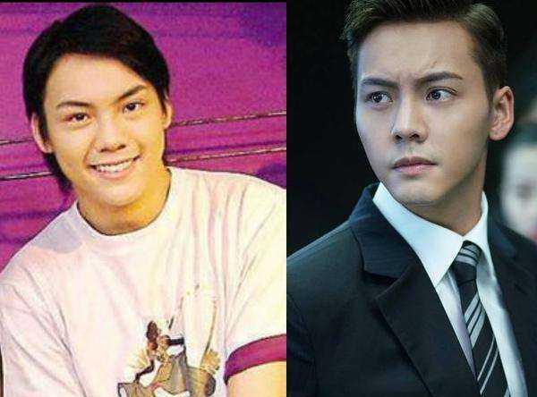 There is a huge gap between the actor before and after plastic surgery ...