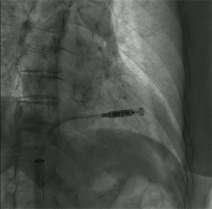 Save the lives of the elderly!Emergency General Hospital successfully ...