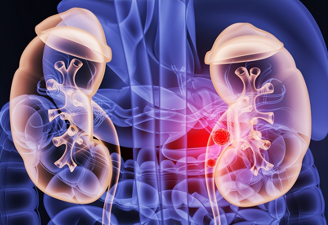 Men with good kidneys generally have these 4 characteristics? If you ...