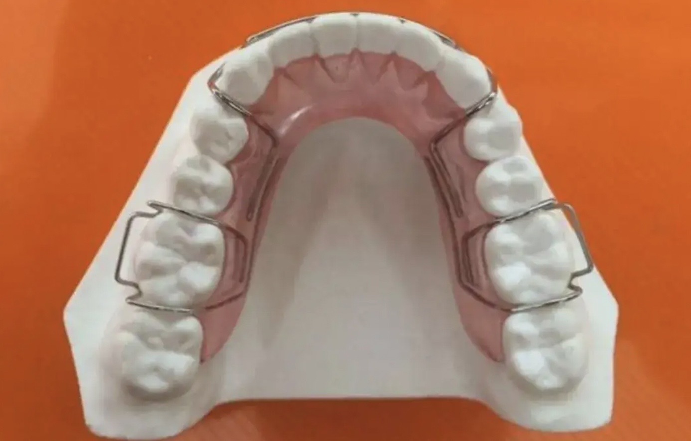 Which retainer is better to wear after correction? - iNEWS