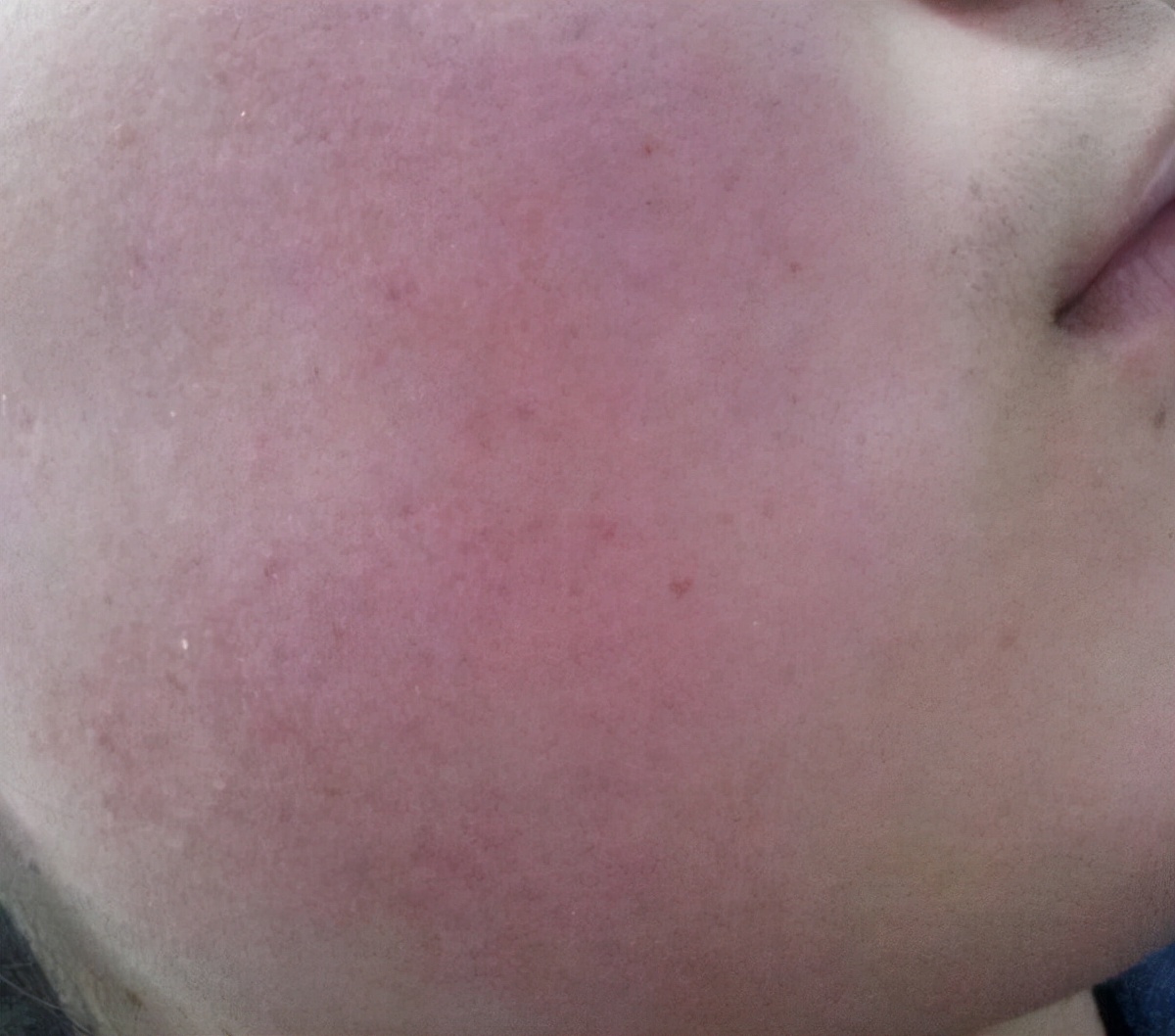 How to eliminate red blood streaks?Ways to lighten red blood streaks ...