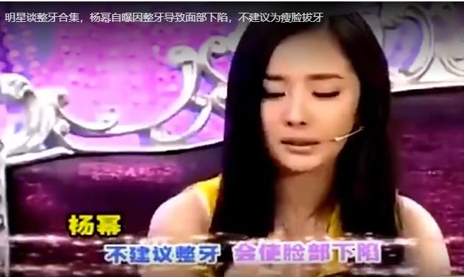 Four actresses who suffered "miserable harm" from plastic surgery, some ...