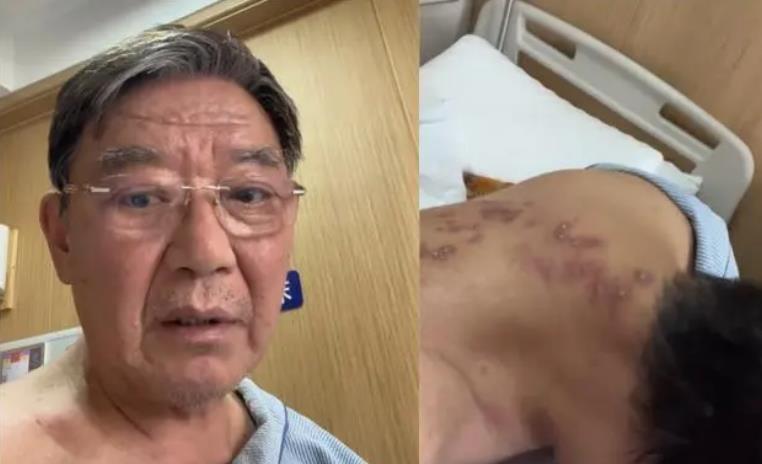 Veteran actor Li Liqun revealed that he is critically ill! She had ...