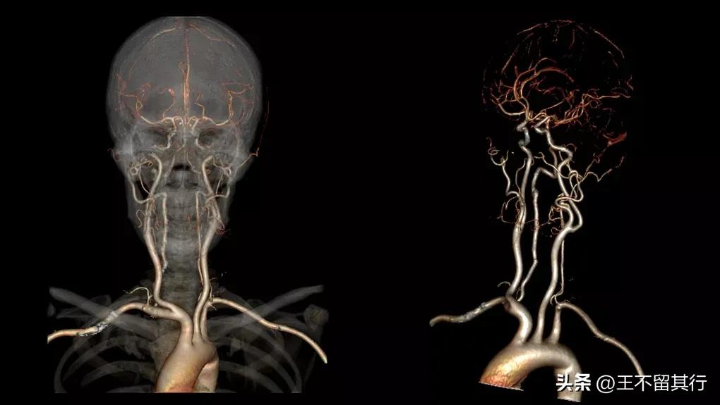 Causes of "dizziness"+ - iNEWS