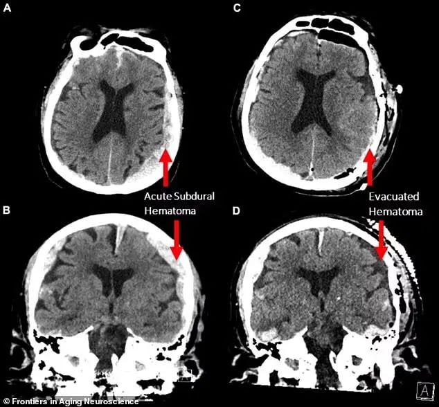 For the first time in history, near-death brain waves are recorded ...