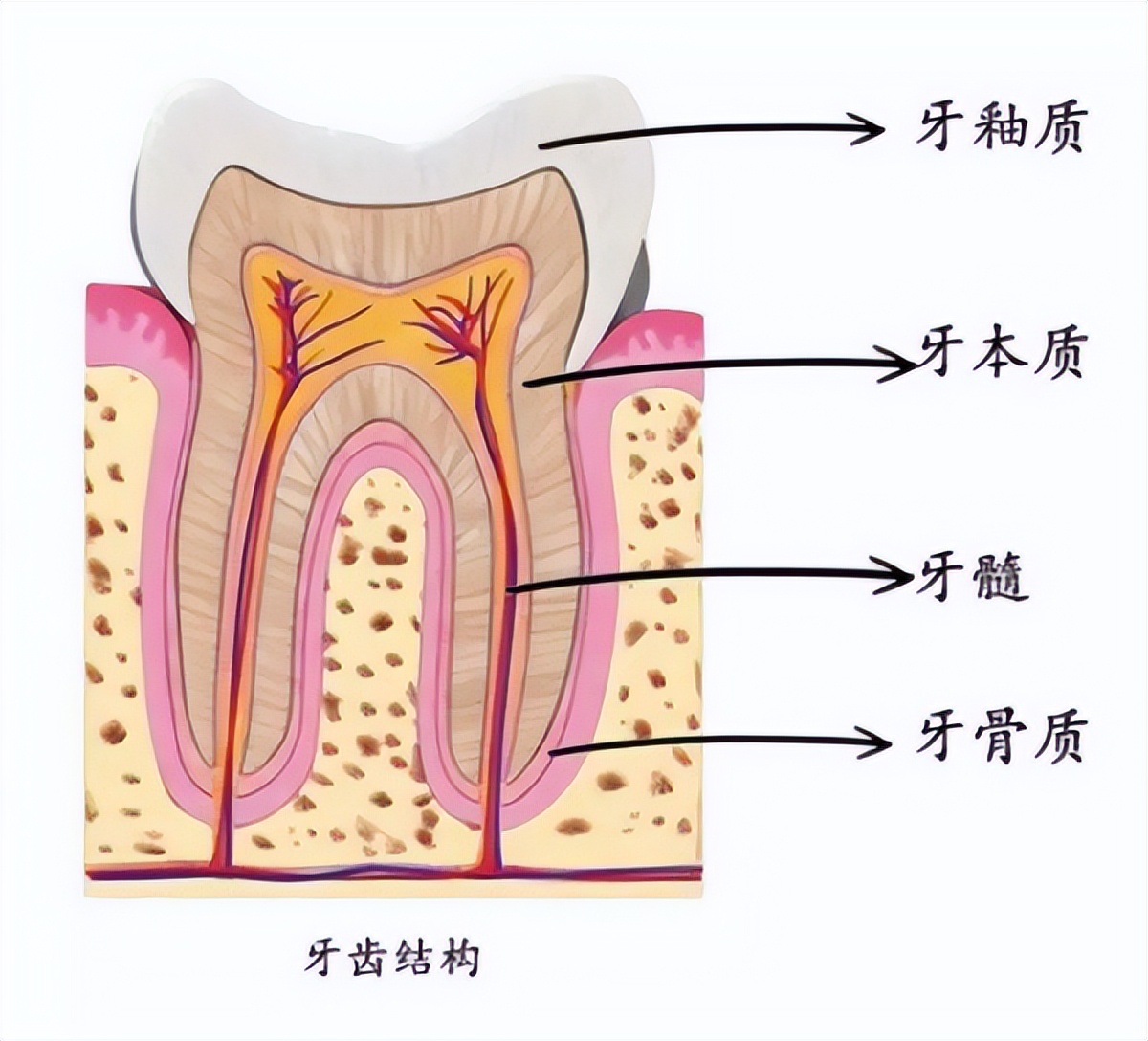 What is a dead pulp tooth?People with dead pulp teeth are more prone to ...