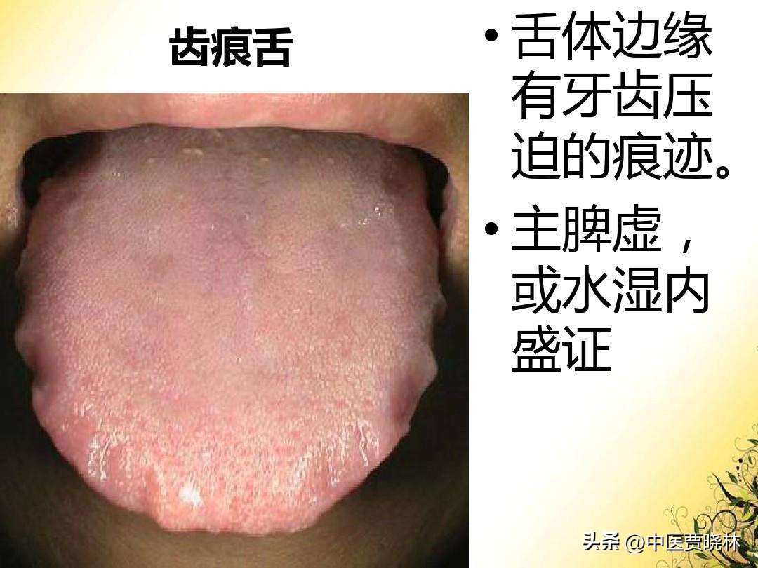 Three proprietary Chinese medicines, expectorating phlegm and clearing ...