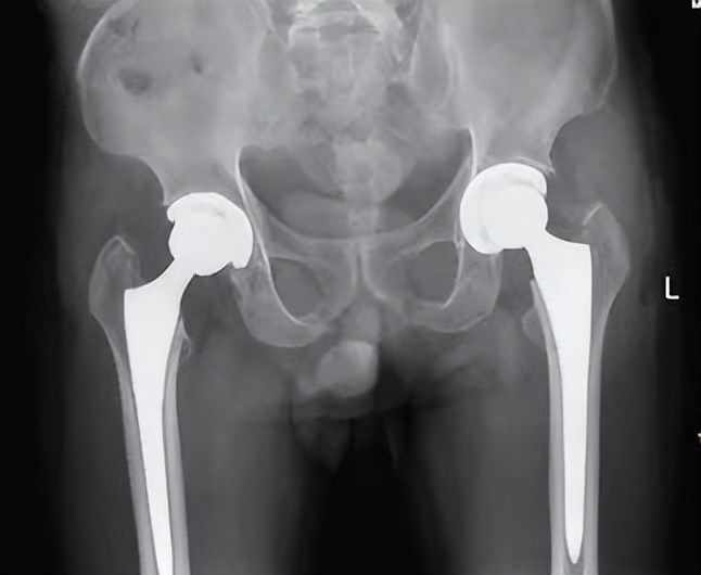 Knee pain was considered "rheumatoid arthritis", but it turned out to ...