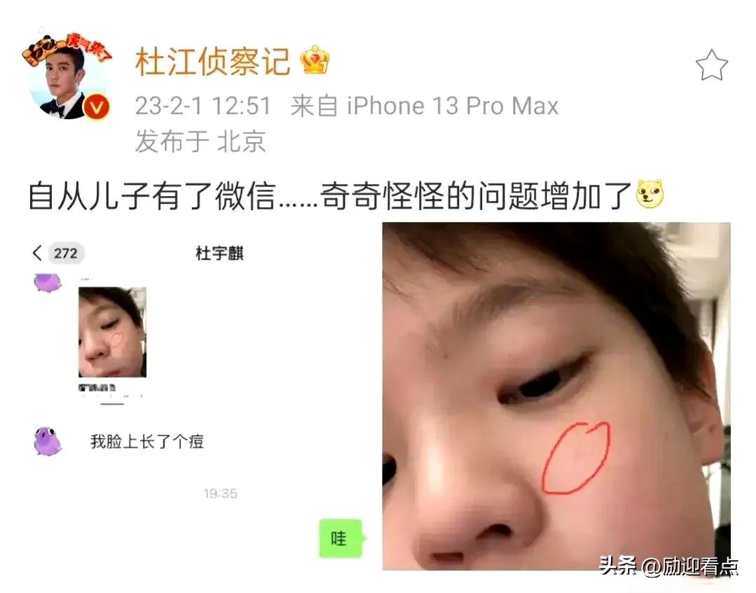 Uh-huh: Dad, I have a pimple on my face.Du Jiang: Wow~ I haven't washed ...