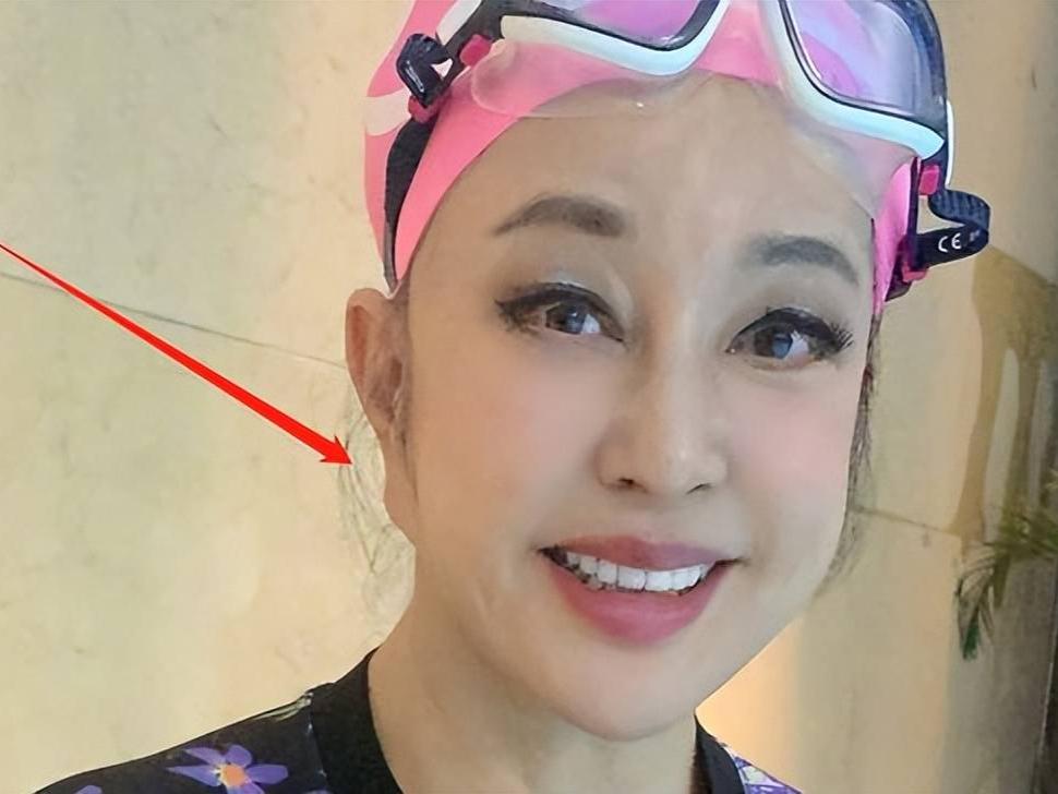 Take stock of the 5 female stars caught in the plastic surgery storm ...