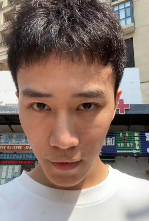 Jiang Zhihao performed a miracle in fighting cancer. After 7 rounds of ...