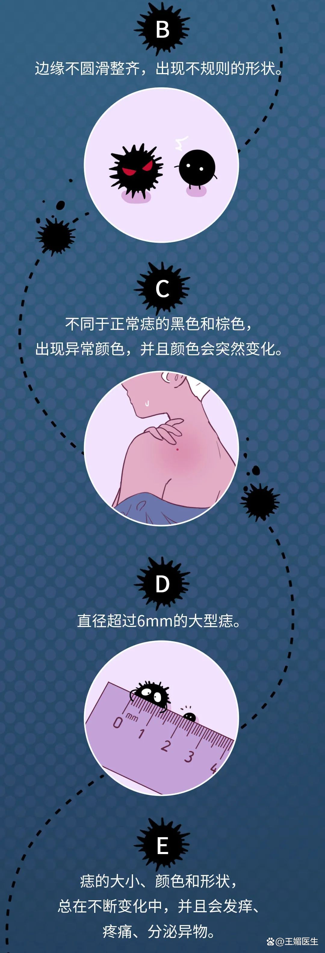 How to distinguish "good" from "bad" moles?Come in and see if your mole ...