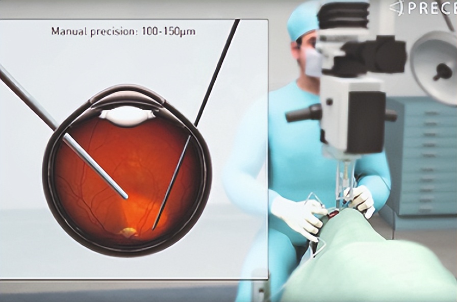 Keqidao: Artificial intelligence robot-assisted system makes retinal ...