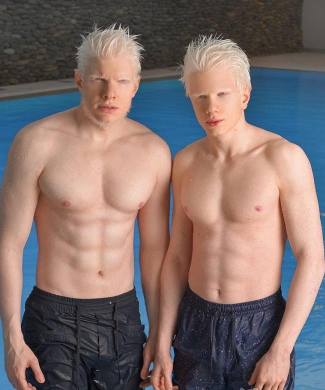 Georgia, the most handsome albino singer, married a young model, gave ...