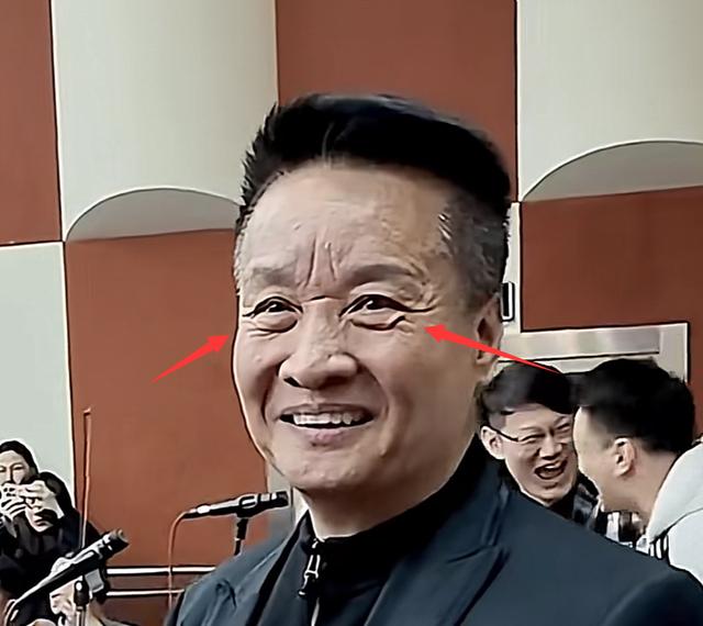 Recent photos of 66-year-old Yan Weiwen were exposed. His face is full ...