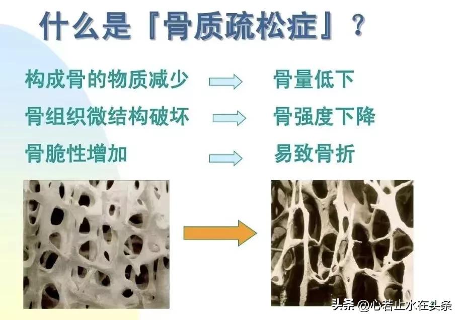 How to eat healthy to prevent osteoporosis? - iNEWS