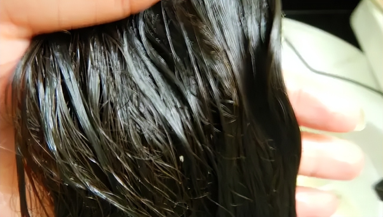 Scalp Health Care Scalp Management: How to Effectively Control Hair Oil ...