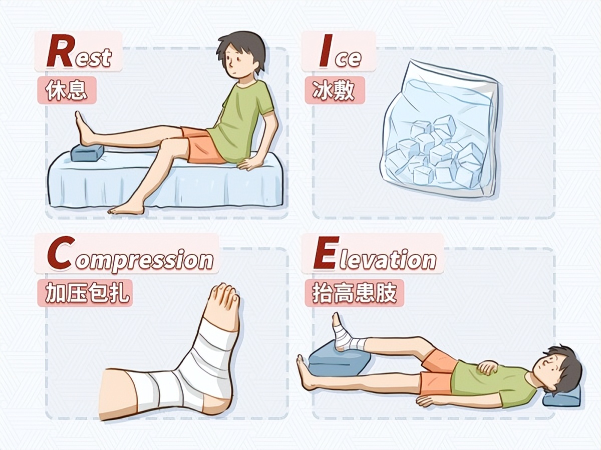 How to deal with emergency after sprained ankle? Is it necessary to go ...
