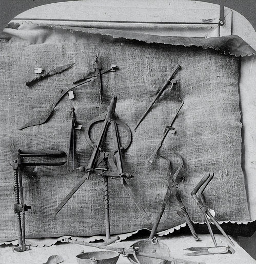 How skilled were ancient Roman doctors? How did they perform the ...