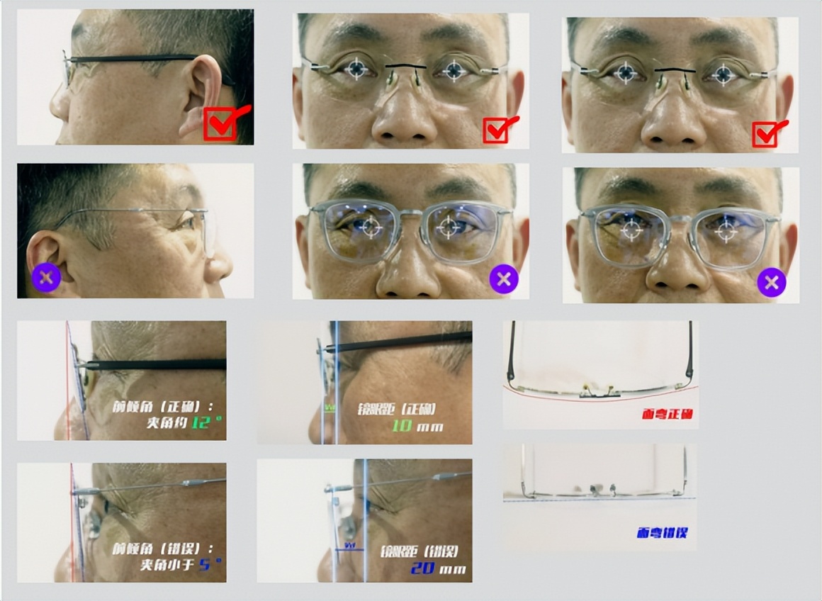 Archimedes 5-degree lens: domestic digital anti-fatigue lens ceiling ...