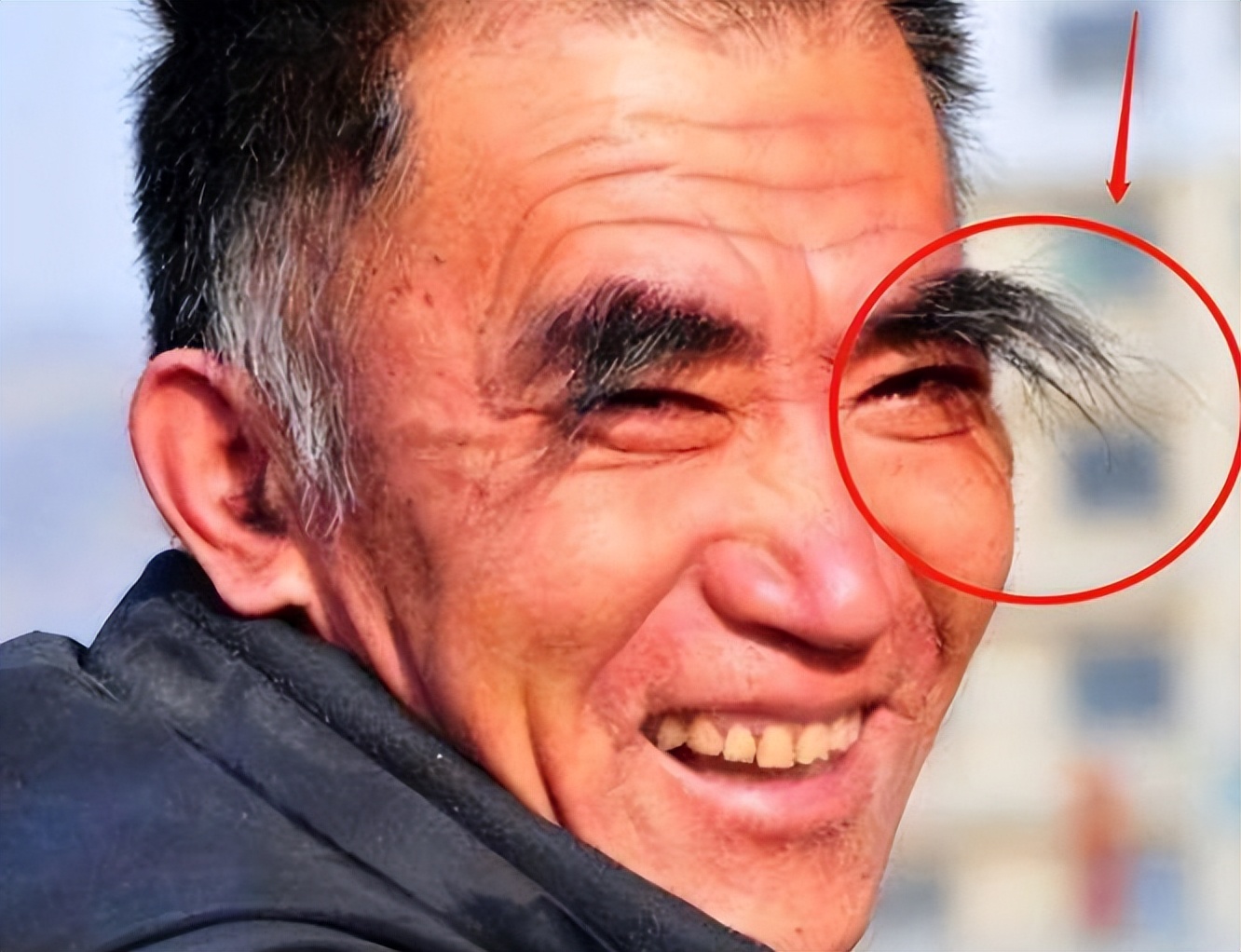 What does it mean when a man's eyebrows grow suddenly after the age of ...